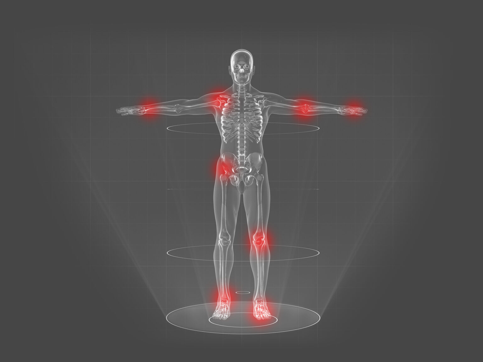 Infiltration sous échographie - Injections PRP et cortisone